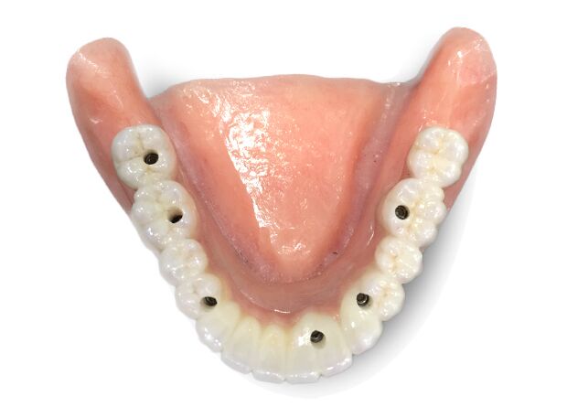 Type of Dentures - Shine Dental Associates